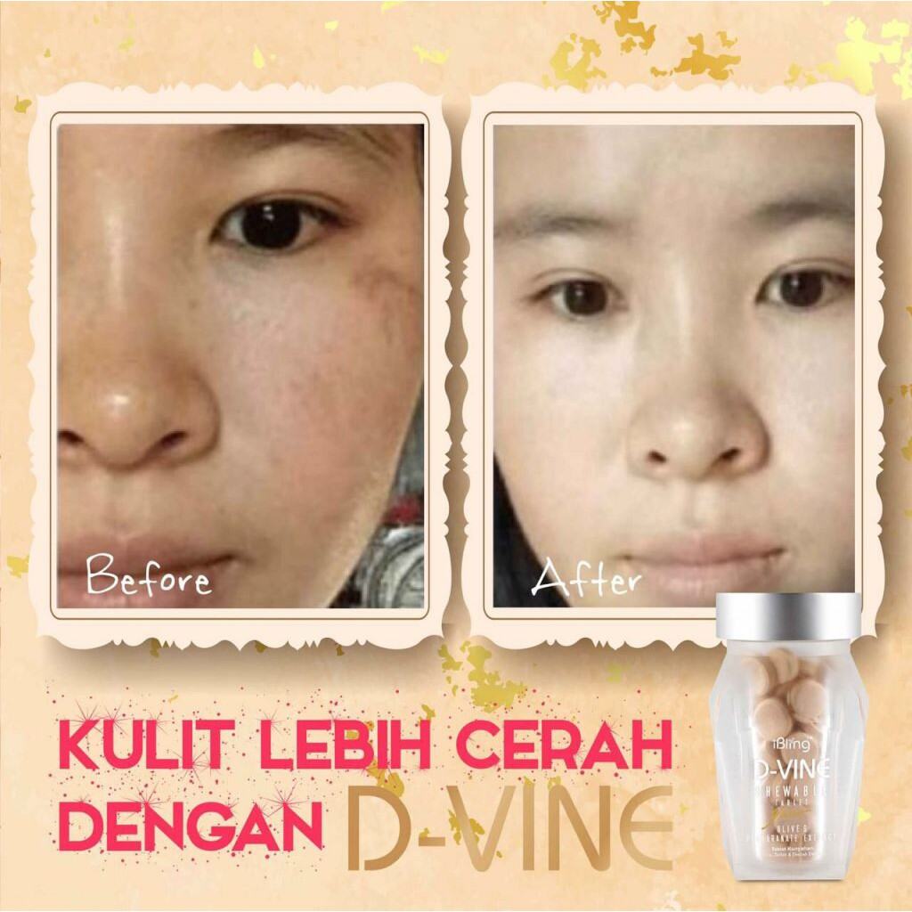 Jual D VINE COLLAGEN CANDY ORIGINAL DVINE D VINE PERMEN COLLAGEN ...