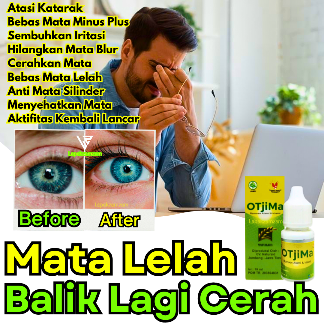 Jual Obat Gelukoma Mata Rabun Terbaru - Jun 2024 | Lazada.co.id