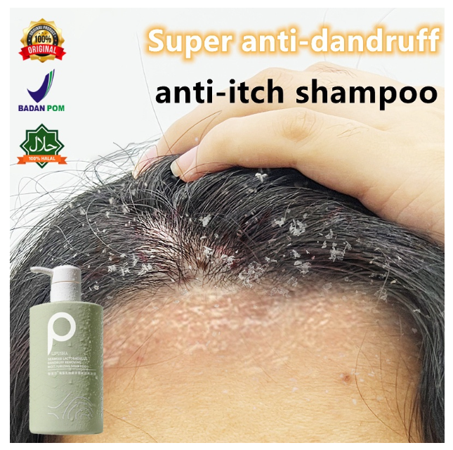 Jual Shampo Anti Ketombe Garam Laut Shampoo 500ml Ketombe Rambut Rontok Berkerak Sampo Terbaru ...